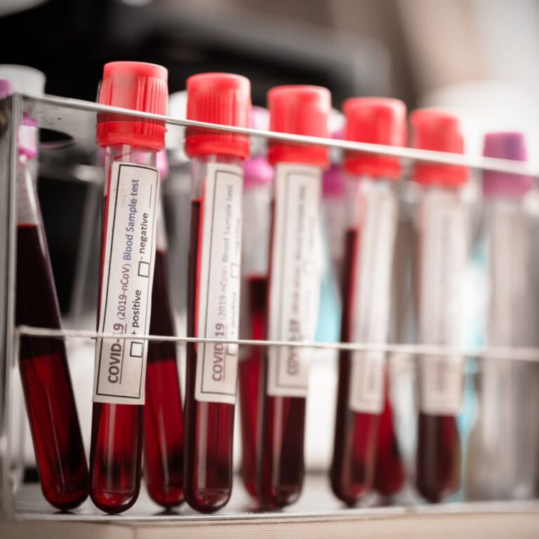 Professional Services Industry Experts | GLG